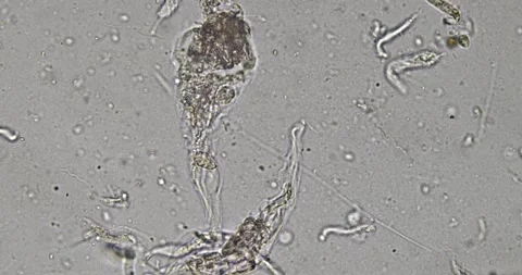 Symbiotic protozoa in termite. Stomach ... | Stock Video | Pond5