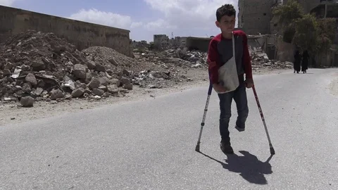 Syrian boy amputee standing in the stree... | Stock Video | Pond5