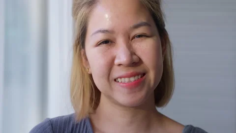 Syringoma or milia milium cysts or sebor... | Stock Video | Pond5