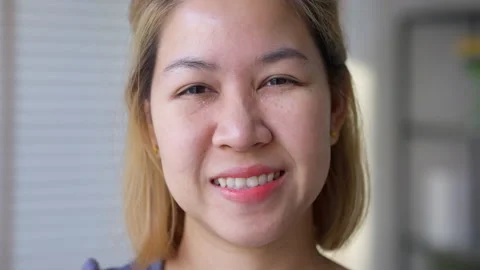 Syringoma or milia milium cysts or sebor... | Stock Video | Pond5