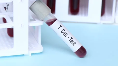 T Cell - Test, blood sample to analyze i... | Stock Video | Pond5