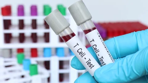 T Cell - Test, blood sample to analyze i... | Stock Video | Pond5