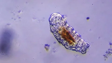 Tardigrade microorganism viewed under mi... | Stock Video | Pond5