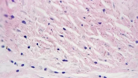 Teased human tendon in cross section mag... | Stock Video | Pond5