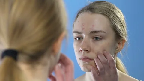 Teen girl with pimply face looking in mi... | Stock Video | Pond5