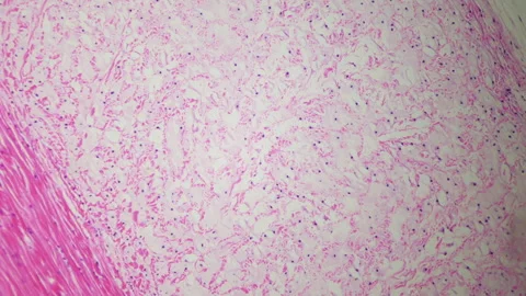 Tendon under microscope. 100x magnificat... | Stock Video | Pond5