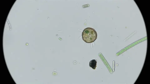 testate amoeba Arcella gibbosa under the... | Stock Video | Pond5