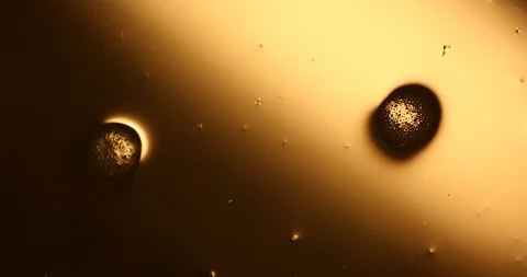 Tests Of Liquid Feces In A Under A Micro... | Stock Video | Pond5