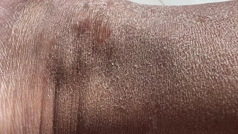 texture of the unhealthy human skin epid... | Stock Video | Pond5