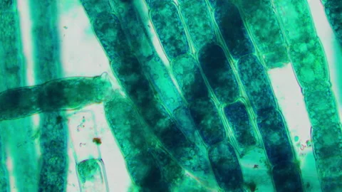 Thin threads of algae one cell thick und... | Stock Video | Pond5
