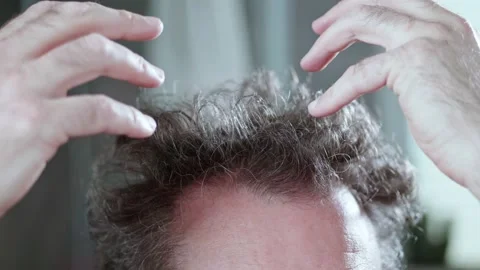 Thinning hair, the problem of hair loss ... | Stock Video | Pond5