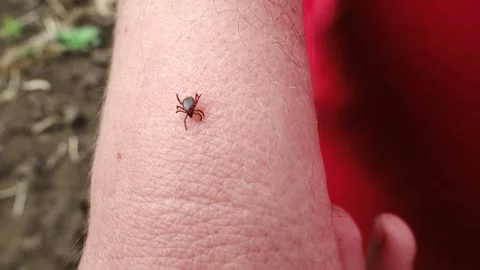 Ticks Insect Stock Videos – Royalty-Free HD & 4K Videos | Pond5
