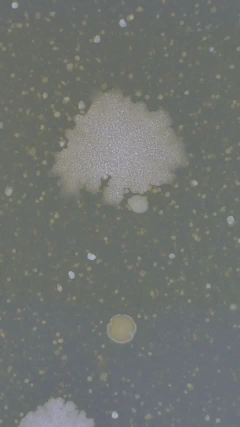 timelapse of growth of pathogenic bacter... | Stock Video | Pond5