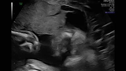 Body Over Baby Stock Videos – Royalty-Free HD & 4K Videos | Pond5
