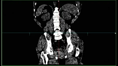Tomography MRI diagnosis data on laborat... | Stock Video | Pond5