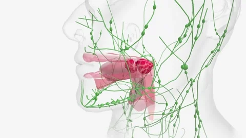 Tonsillitis is inflammation of the tonsi... | Stock Video | Pond5