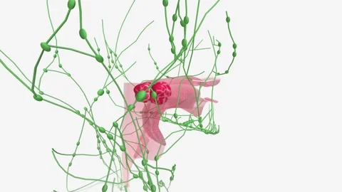 Tonsillitis is inflammation of the tonsi... | Stock Video | Pond5