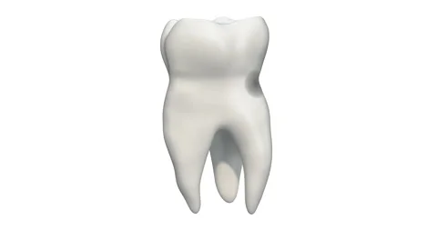Tooth with caries, 3d animation. 3D rend... | Stock Video | Pond5
