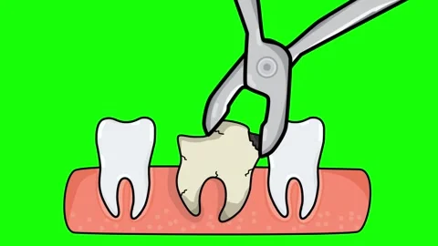 Tooth Extraction: Flying Stock Video Footage | Royalty Free Tooth ...