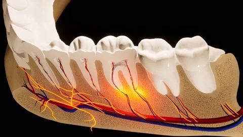 Toothache. Anatomical detailed section o... | Stock Video | Pond5