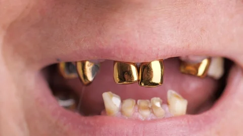 Toothless Mouth. Toothless smile of an e... | Stock Video | Pond5
