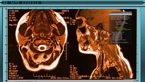 Brain Cross Section Stock Footage ~ Royalty Free Stock Videos | Pond5
