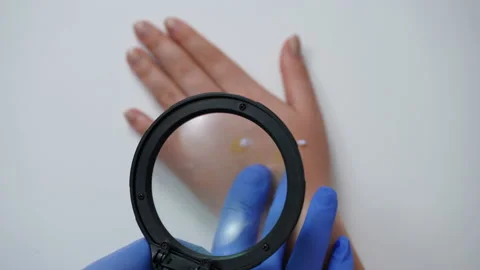 Top view loupe with doctor hand in glove... | Stock Video | Pond5