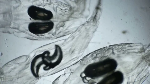 a transparent larva under the microscope... | Stock Video | Pond5