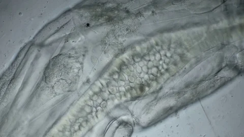a transparent larva under the microscope... | Stock Video | Pond5