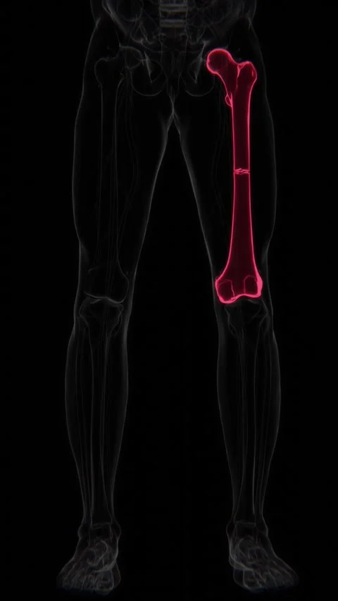 Transverse Fracture in Vertical HQ Video... | Stock Video | Pond5