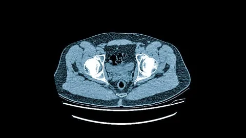Transverse view or axial plain of CT che... | Stock Video | Pond5