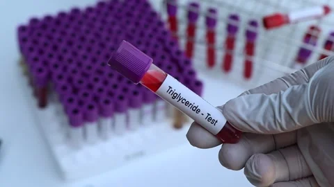 Triglyceride test to look for abnormalit... | Stock Video | Pond5