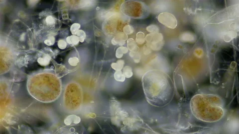 Trochophore larvae under a microscope, p... | Stock Video | Pond5