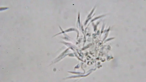 Trypanosoma cruzi microscope view; human... | Stock Video | Pond5