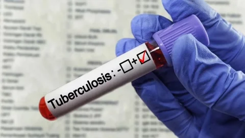 Test Tube Blood Stock Videos – Royalty-Free HD & 4K Videos