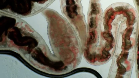 Tubifex worm under a microscope, the Nai... | Stock Video | Pond5