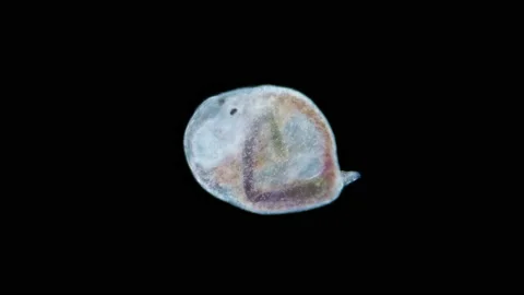 Turbellaria worm under the microscope, P... | Stock Video | Pond5