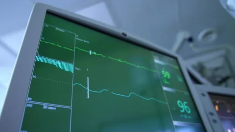 Two curved lines running on the green sc... | Stock Video | Pond5