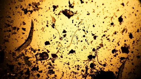 Dirty Drop Of Water Under A Microscope Stock Videos – Royalty-Free HD ...