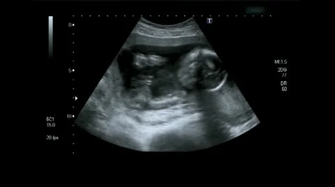 Baby Body Scan Stock Videos – Royalty-Free HD & 4K Videos | Pond5