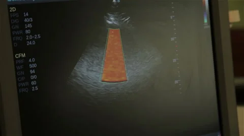 Heart Review Monitor Stock Footage ~ Royalty Free Stock Videos | Pond5