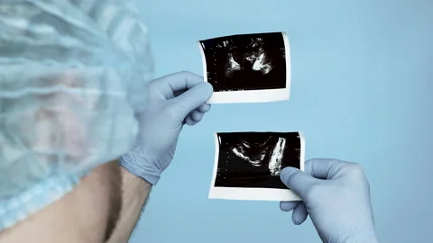 Ultrasound of the prostate gland of a ma... | Stock Video | Pond5