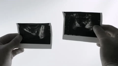 Picture Of Whute Stock Videos – Royalty-Free HD & 4K Videos | Pond5