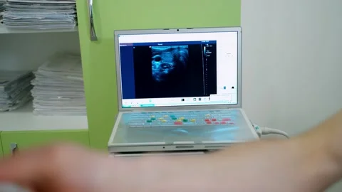 Ultrasound Scanning Stock Video Footage | Royalty Free Ultrasound ...