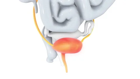 Urinary tract infection, cystitis, 3d an... | Stock Video | Pond5