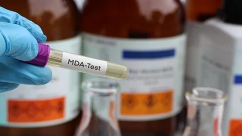 Urine Lab Testing Stock Videos – Royalty-Free HD & 4K Videos