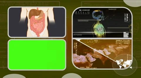 Vector Digestion - Analysis in software ... | Stock Video | Pond5