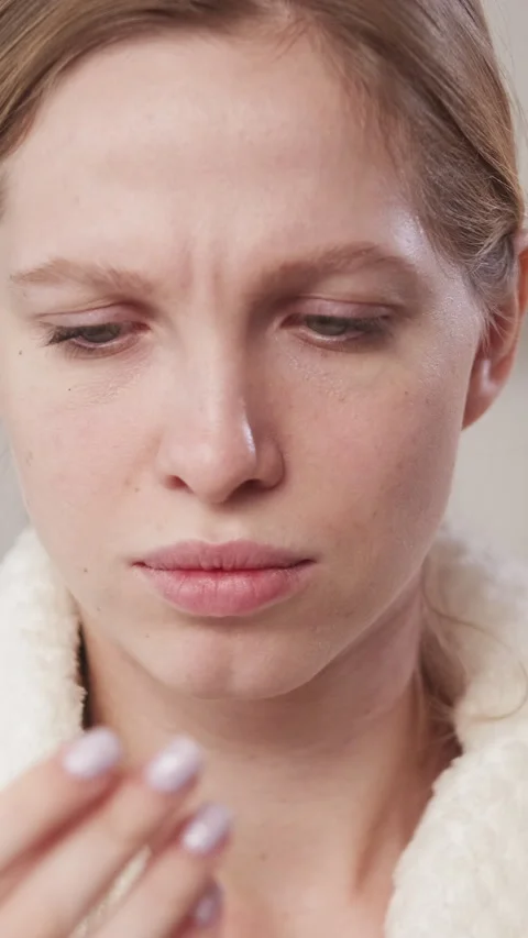 Bad Skin Stock Videos – Royalty-Free HD & 4K Videos | Pond5