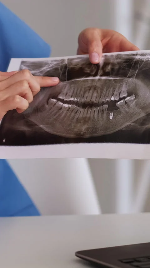 Vertical dental radiologist teeth x-ray ... | Stock Video | Pond5