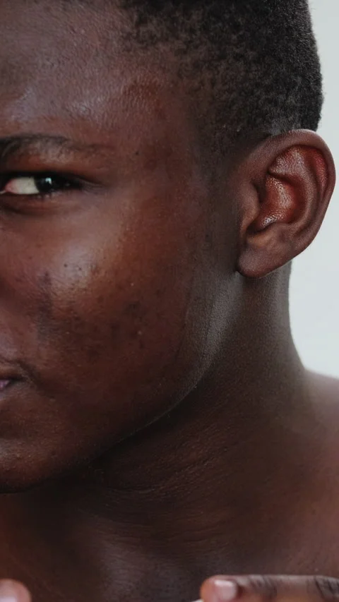 Skin Irritation Stock Video Footage | Royalty Free Skin Irritation ...